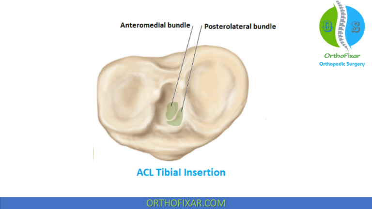 ACL Injury - Easy Explained | OrthoFixar 2026