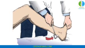 Achilles Reflex Test Explained Easily | OrthoFixar