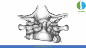 Alar Ligament Test Explained Easily | OrthoFixar
