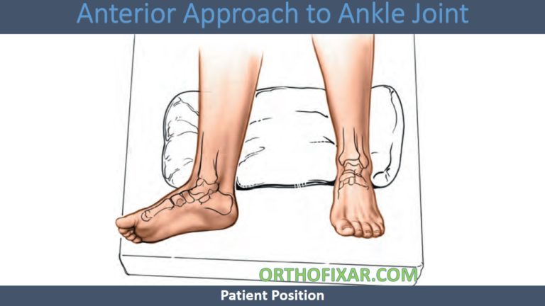Anterior Approach To Ankle Joint Easily Explained | OrthoFixar