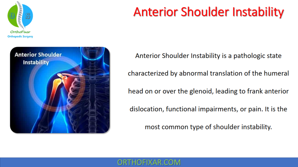 Anterior Shoulder Instability | OrthoFixar 2025