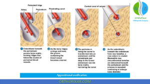 Bone Formation & Development | OrthoFixar