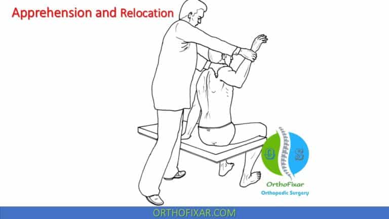 Shoulder Apprehension Test • Easily Explained | OrthoFixar 2025