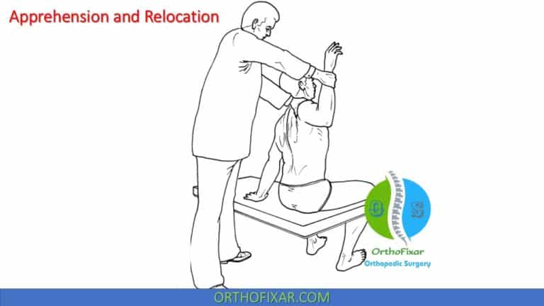 Shoulder Apprehension Test • Easily Explained | OrthoFixar 2025