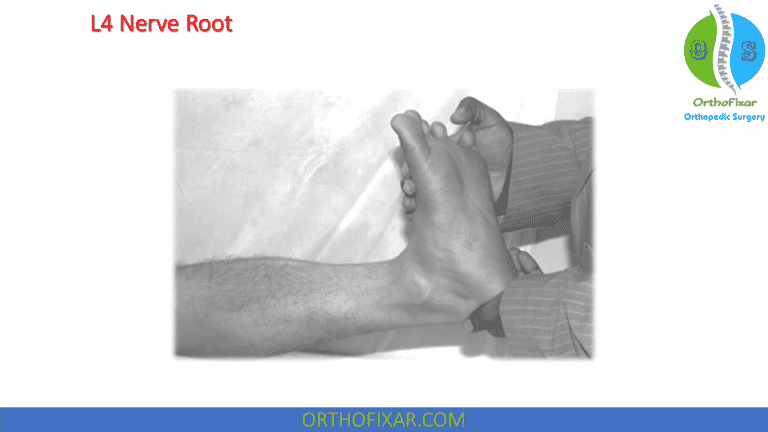 Lumbar Spine Nerve Roots Explained Easily | OrthoFixar