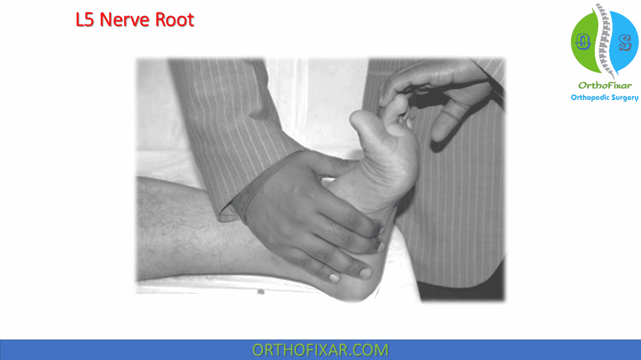 Lumbar Spine Nerve Roots Explained Easily | OrthoFixar
