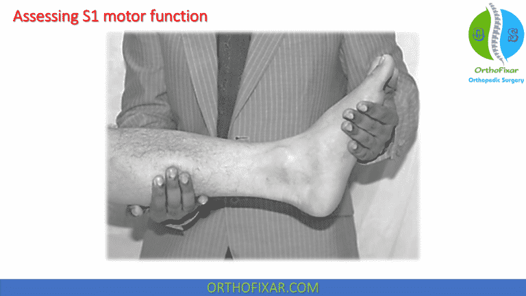 S1 Nerve Root Examination | OrthoFixar 2025