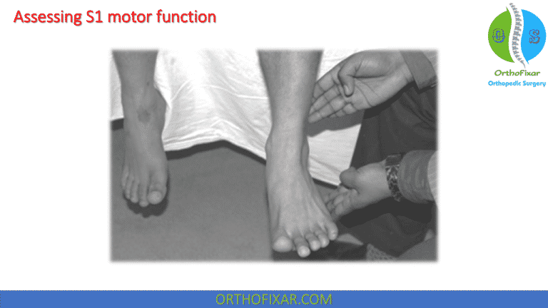 S1 Nerve Root Examination | OrthoFixar 2025