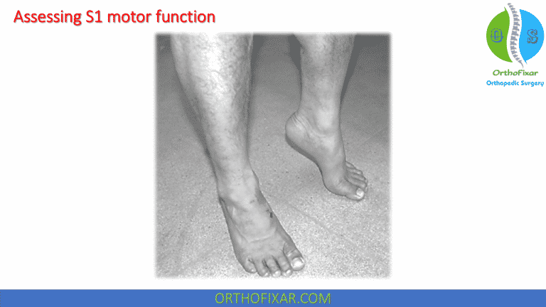 S1 Nerve Root Examination | OrthoFixar 2025