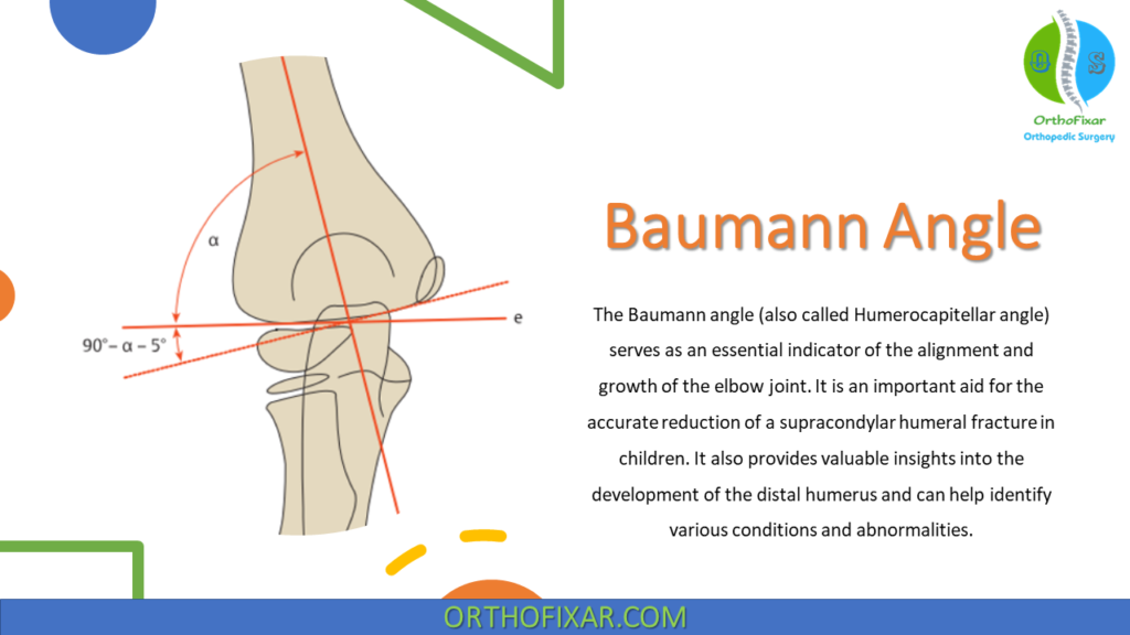 Baumann Angle For Elbow Joint Alignment Explained Easily | OrthoFixar