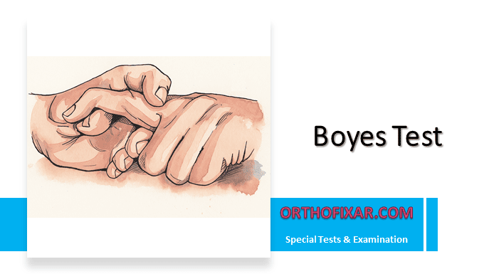 Clunk Test Explained Easily | OrthoFixar