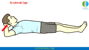 Kernig Sign & Brudzinski Sign Explained Easily | OrthoFixar