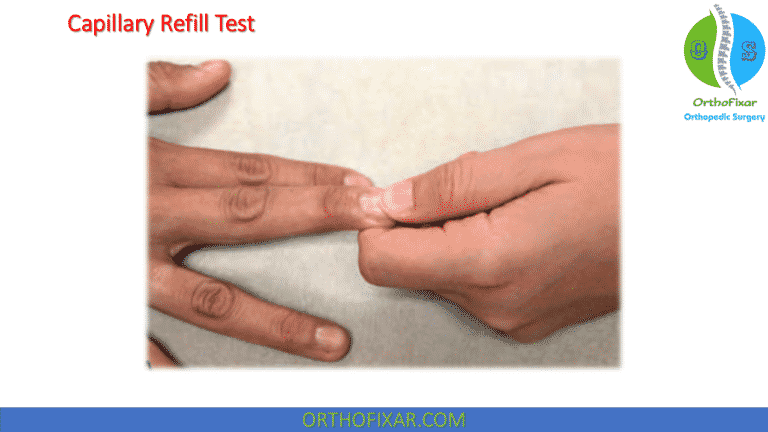 Capillary Refill Test & Time - Easy Explained | OrthoFixar 2025