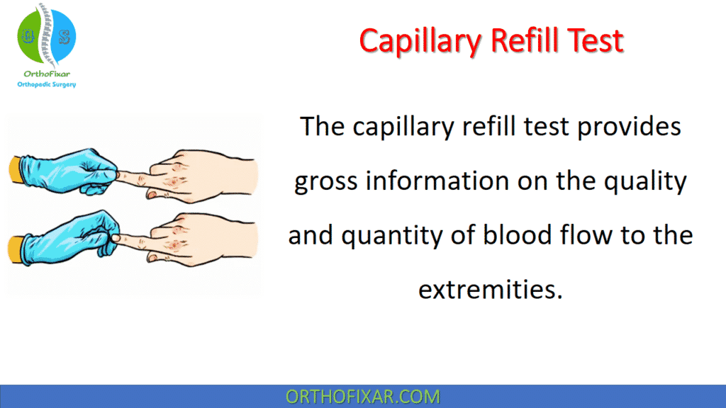 Capillary Refill Test & Time - Easy Explained | OrthoFixar 2025
