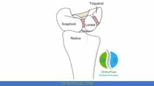 Lunotriquetral Ballottement Test • Easy Explained | OrthoFixar