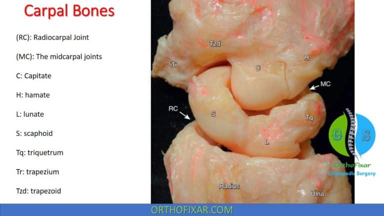 Lunotriquetral Ballottement Test • Easy Explained | OrthoFixar