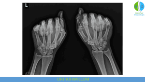 Wrist Radiology Imaging | OrthoFixar