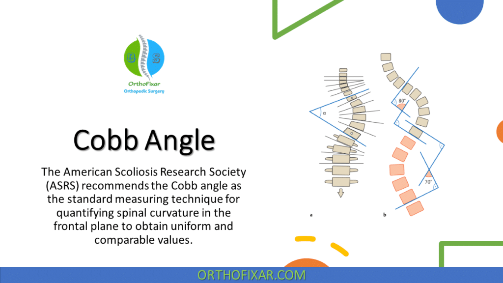 Cobb Angle For Scoliosis Explained Easily | OrthoFixar