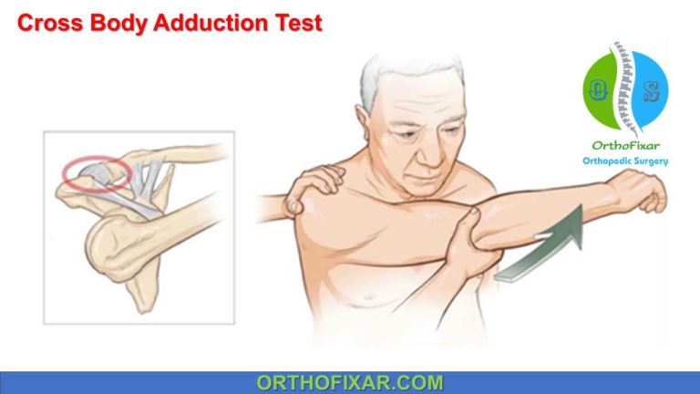 Cross Body Adduction Test • Easy Explained | OrthoFixar 2025