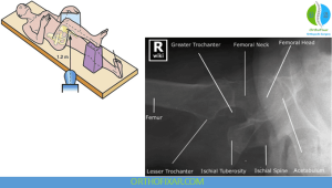 Hip Joint X-Ray Imaging | OrthoFixar