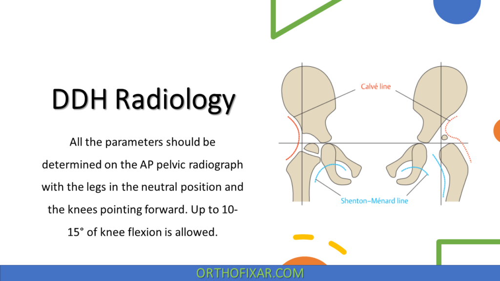 DDH Radiology Explained Easily | OrthoFixar