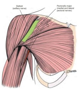 Shoulder Deltopectoral Approach | OrthoFixar 2025