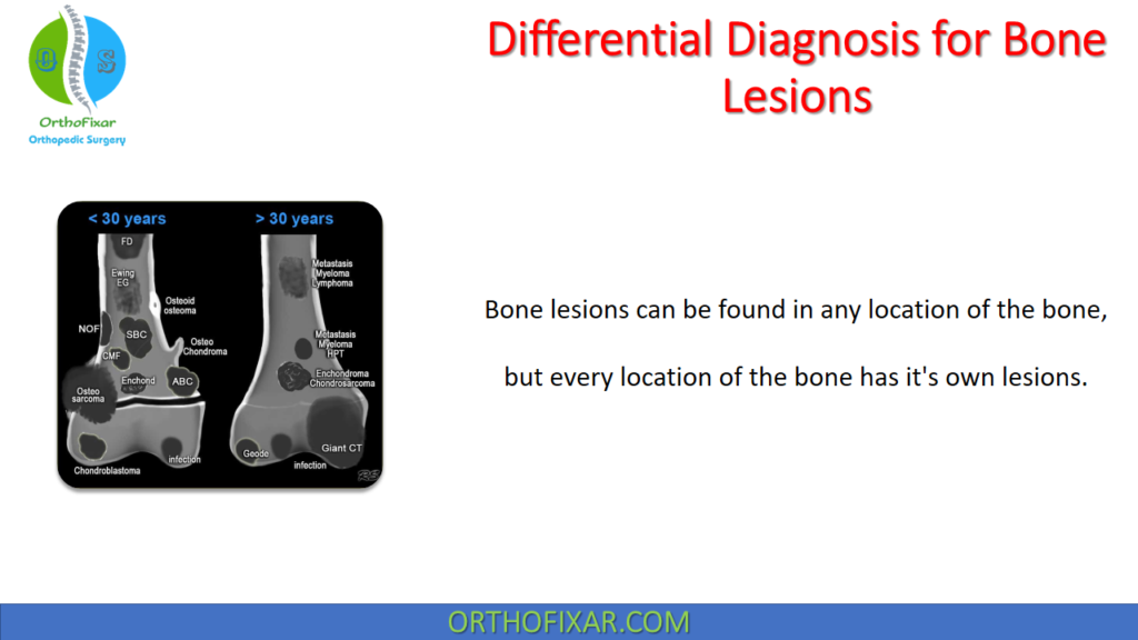 Differential Diagnosis For Bone Lesions | OrthoFixar