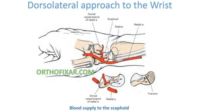 Dorsolateral Approach To The Wrist Easily Explained | OrthoFixar