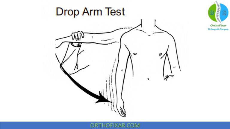 Drop Arm Test For Supraspinatus Tear Explained Easily | OrthoFixar