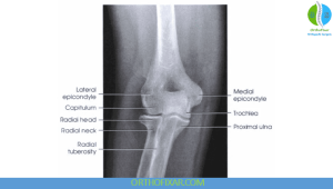 Elbow X-ray Views | OrthoFixar