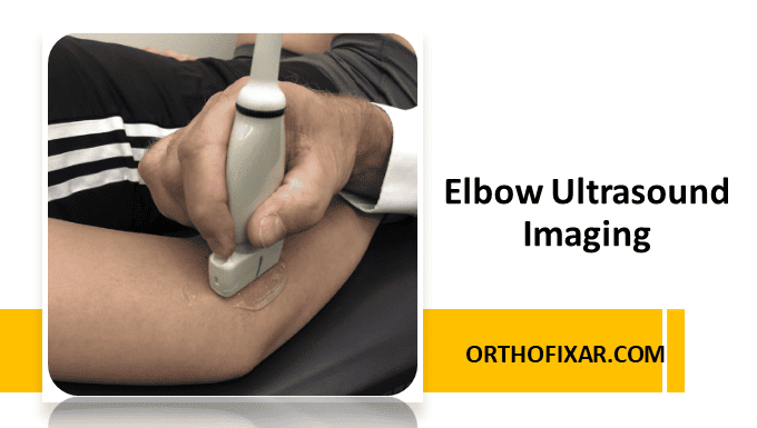 Elvey Test | Upper Limb Tension Tests (ULTTs) Overview 2025