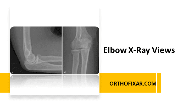 Elbow X-ray Views | OrthoFixar