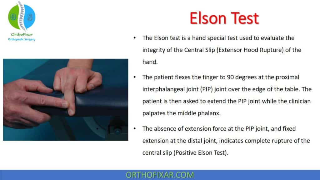 Mill's Test | Lateral Epicondylitis Assessment | OrthoFixar 2024