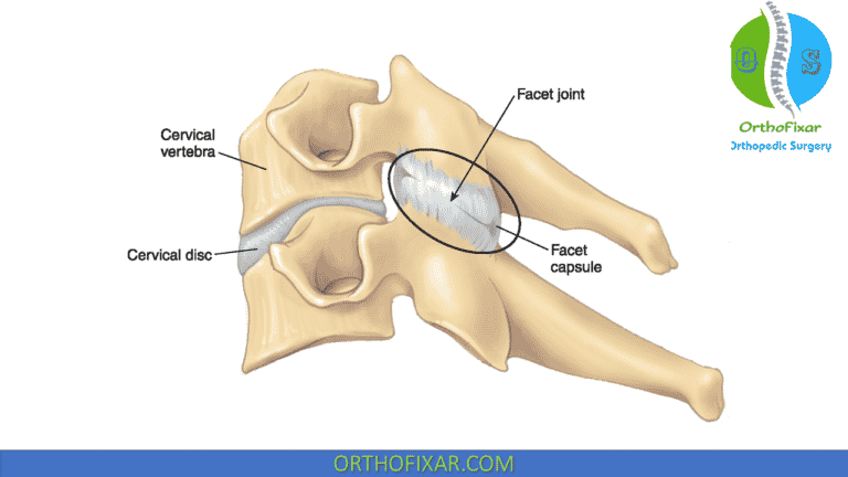 Facet Joint Dysfunction | OrthoFixar