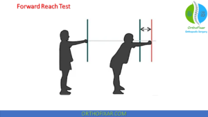Balance Tests & Assessment | Dynamic & Static Explained Easily | OrthoFixar