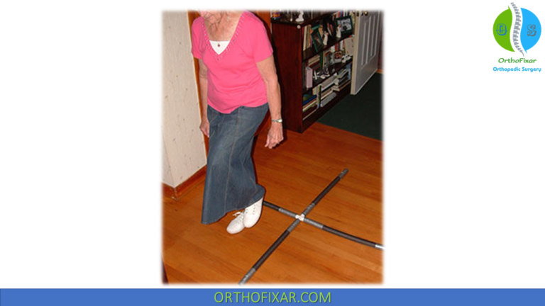 Four Square Step Test Explained Easily | OrthoFixar