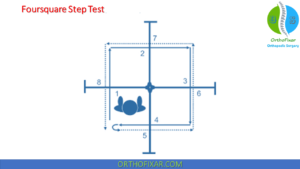 Balance Tests & Assessment | Dynamic & Static Explained Easily | OrthoFixar
