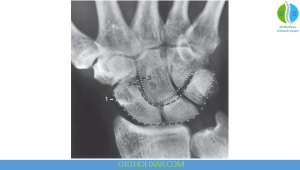 Wrist Radiology Imaging