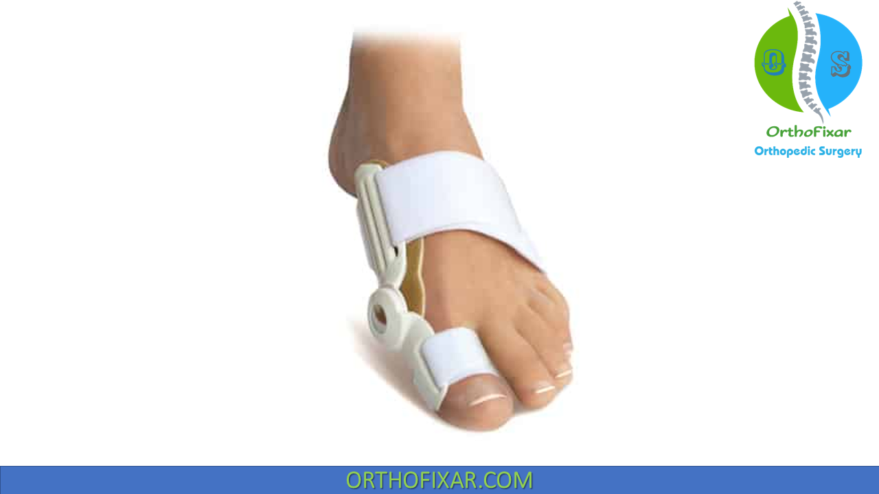 Adult Hallux Valgus - Easy Explained | OrthoFixar 2026