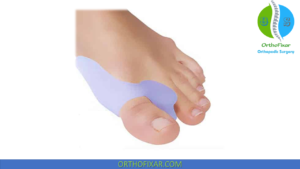 Adult Hallux Valgus - Easy Explained | OrthoFixar 2025