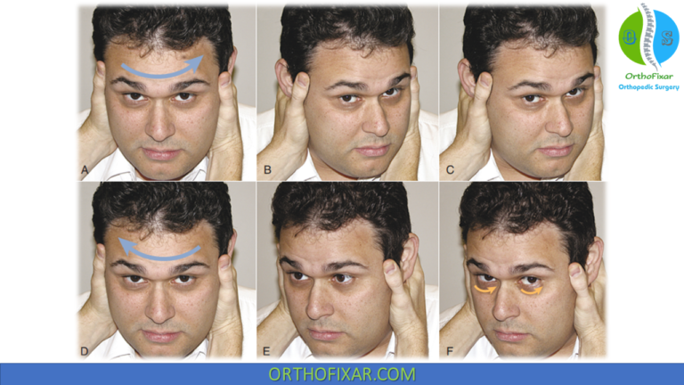 Head Thrust Test For Vestibular Assessment Explained Easily | OrthoFixar