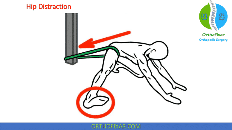 Hip Mobility Exercises | OrthoFixar 2026