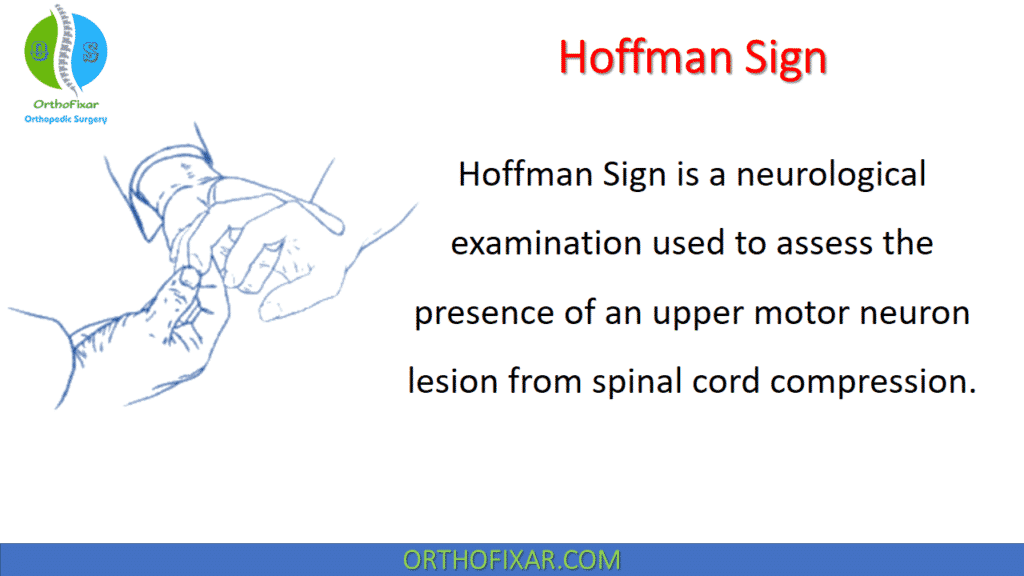 Hoffman Sign For Upper Motor Neuron Explained Easily | OrthoFixar