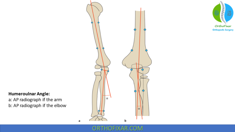 Carrying Angle Of Elbow
