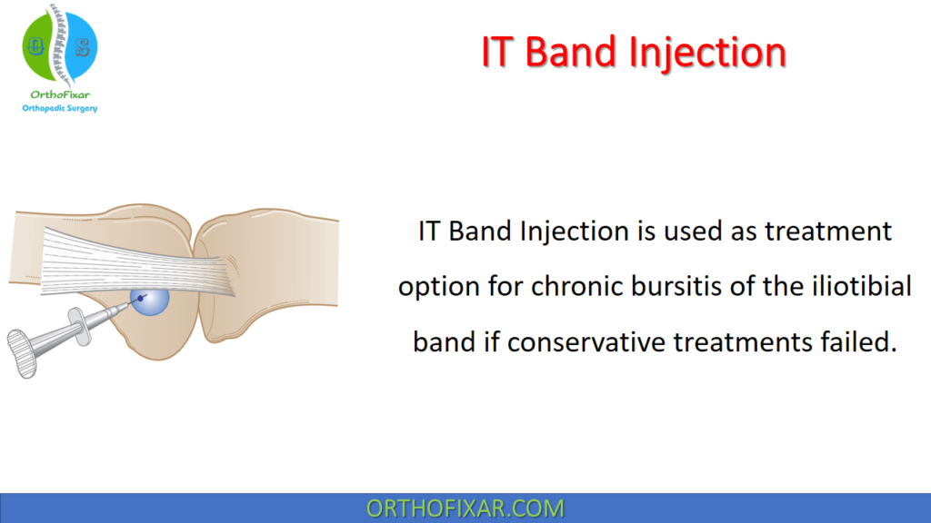 IT Band Injection Easy Explained | OrthoFixar 2025