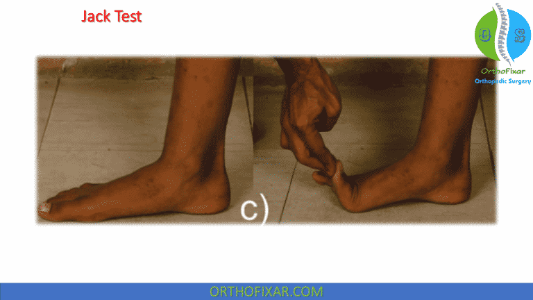 Slump Test Easy Explained Orthofixar 2022 - Bank2home.com