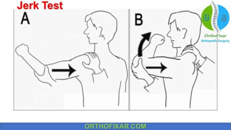 Jerk Test Overview - Easily Explained | OrthoFixar 2025