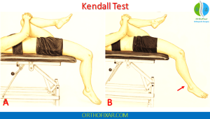 Kendall Test (Rectus Femoris Contracture Test) Explained Easily ...