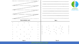King Devick Test | Assessing Oculomotor Function Explained Easily ...