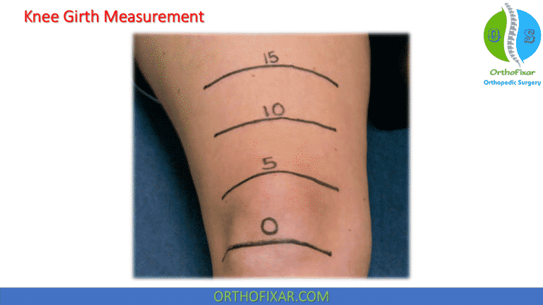 Knee Girth Measurement Explained Easily | OrthoFixar